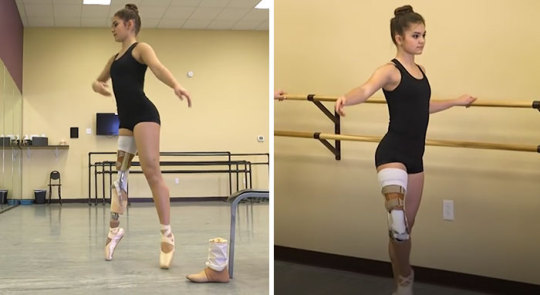 15-Year-Old Amputee Ballerina Who Lost Her Leg To Cancer, Fulfills Her ... 15-Year-Old Amputee Ballerina Who Lost Her Leg To Cancer, Fulfills Her ...