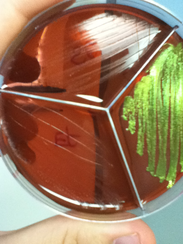 A Scientific Spectrum Emb Eosin Methylene Blue Agar Is Both A